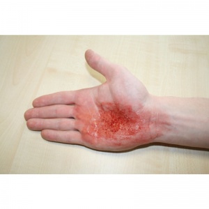 Nursing Care Wound Kit - MedicalSupplies.co.uk