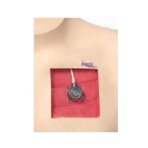 Deluxe Venous Access Device Model - MedicalSupplies.co.uk