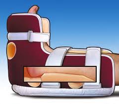 Pressure Relief Boots - MedicalSupplies.co.uk