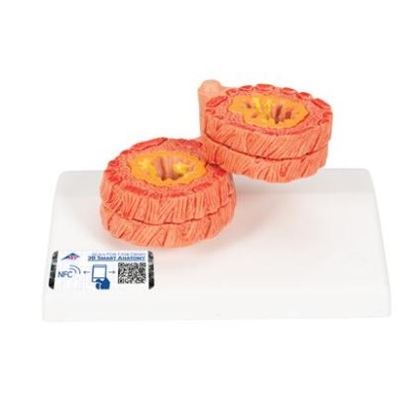 3B Scientific COPD Bronchial Tissue Model - MedicalSupplies.co.uk