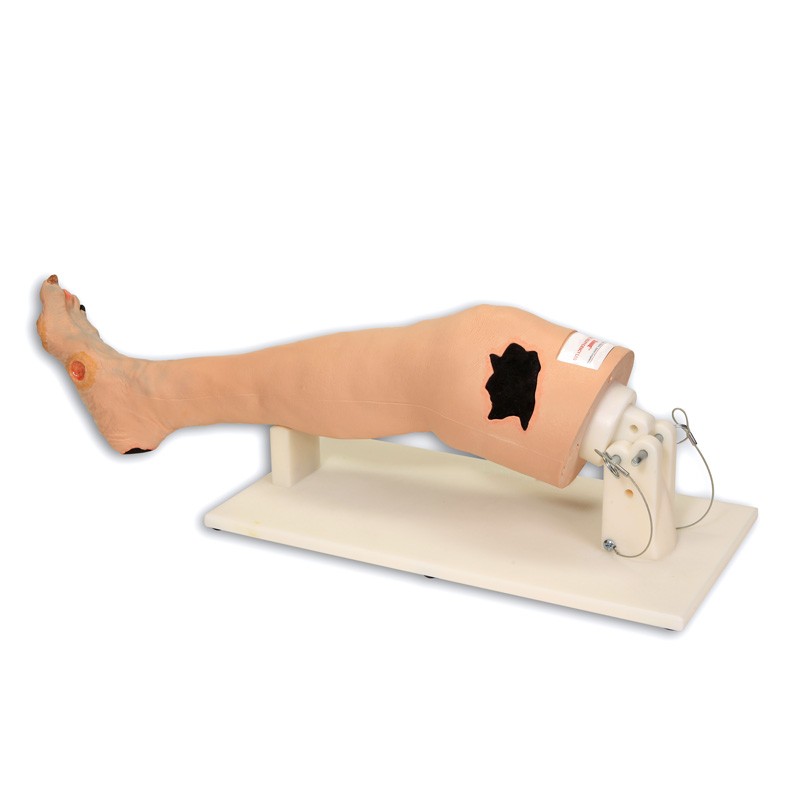 Erler-Zimmer Arterial Insufficiency Leg - MedicalSupplies.co.uk