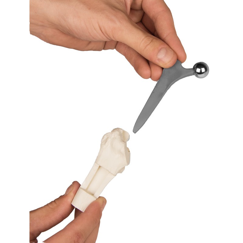 Hip Joints Model (Set of 3) - MedicalSupplies.co.uk