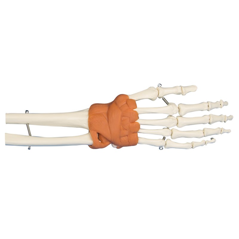 Skeleton Hand and Wrist Model - MedicalSupplies.co.uk
