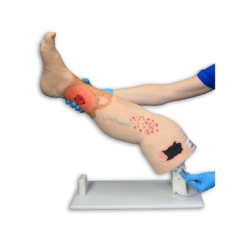 "Vinnie" Venous Insufficiency Leg Model - MedicalSupplies.co.uk