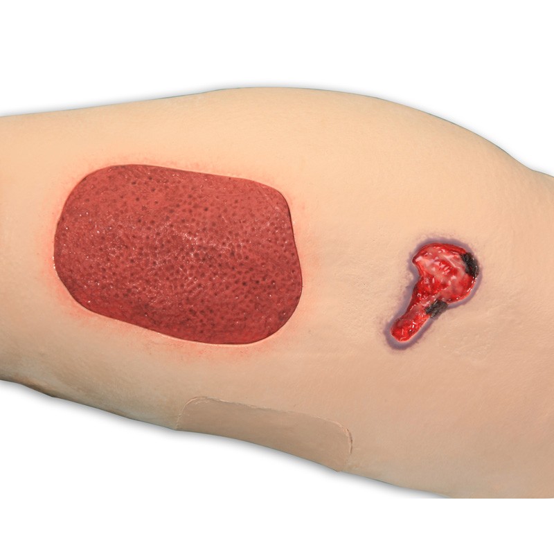 "Vinnie" Venous Insufficiency Leg Model - MedicalSupplies.co.uk