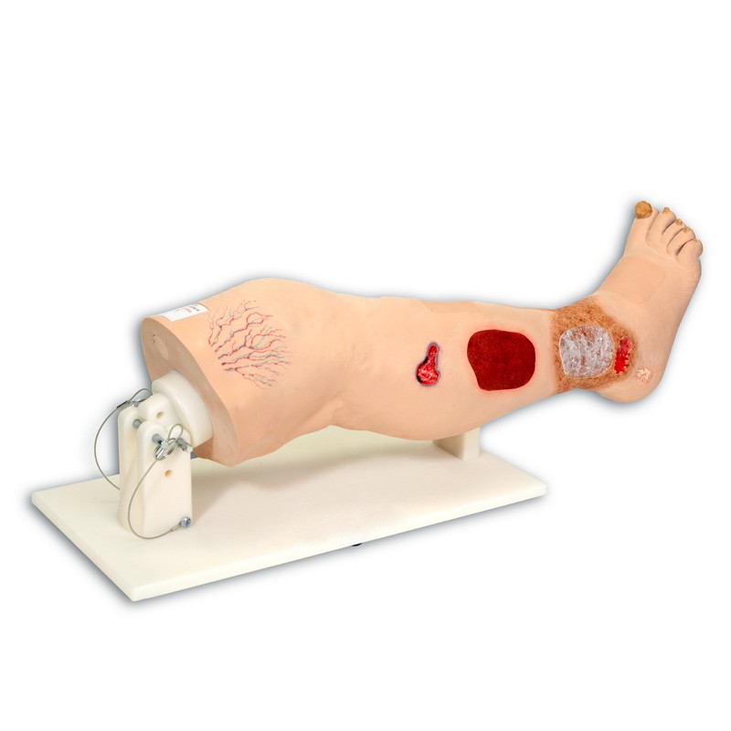 "Vinnie" Venous Insufficiency Leg Model - MedicalSupplies.co.uk