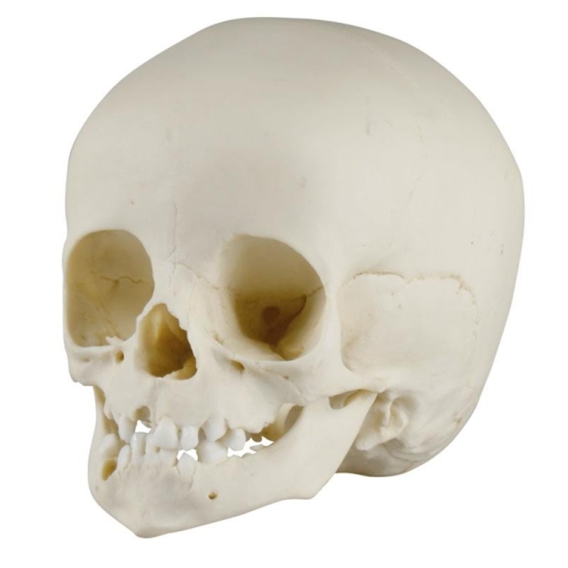 Paediatric Skull Cast (14-Month-Old) - MedicalSupplies.co.uk