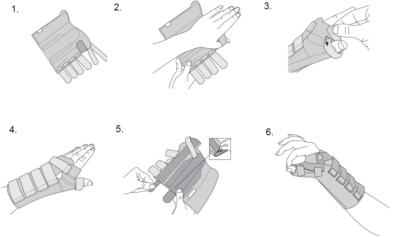 Procool Deluxe Skier's Thumb Splint - MedicalSupplies.co.uk