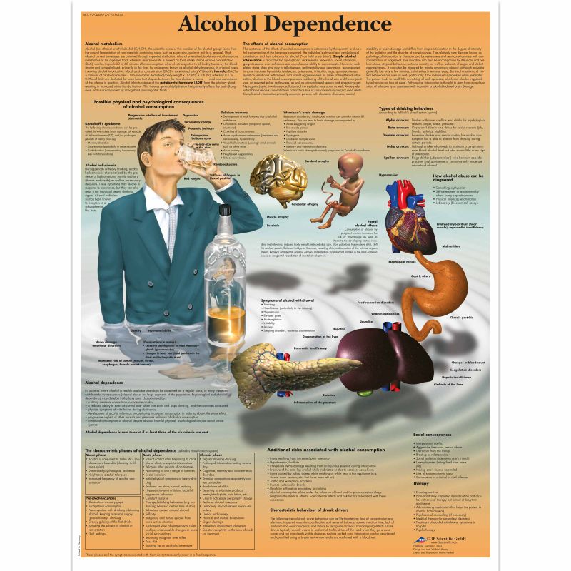 Alcohol Dependence Chart - MedicalSupplies.co.uk