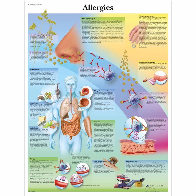 Allergies Chart - MedicalSupplies.co.uk