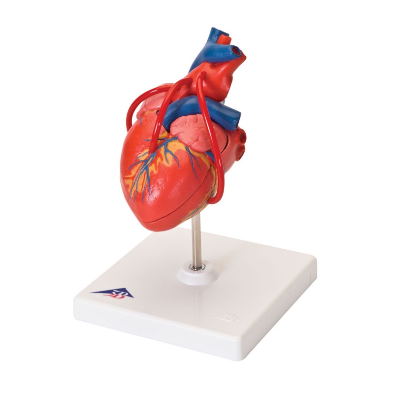 Classic Heart Model with Bypass (2-Part) - MedicalSupplies.co.uk