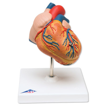 3B Scientific Heart Model with Left Ventricular Hypertrophy (2-Part ...