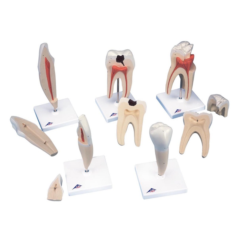 Classic Tooth Models (5 Options, 23 - 29cm) - MedicalSupplies.co.uk