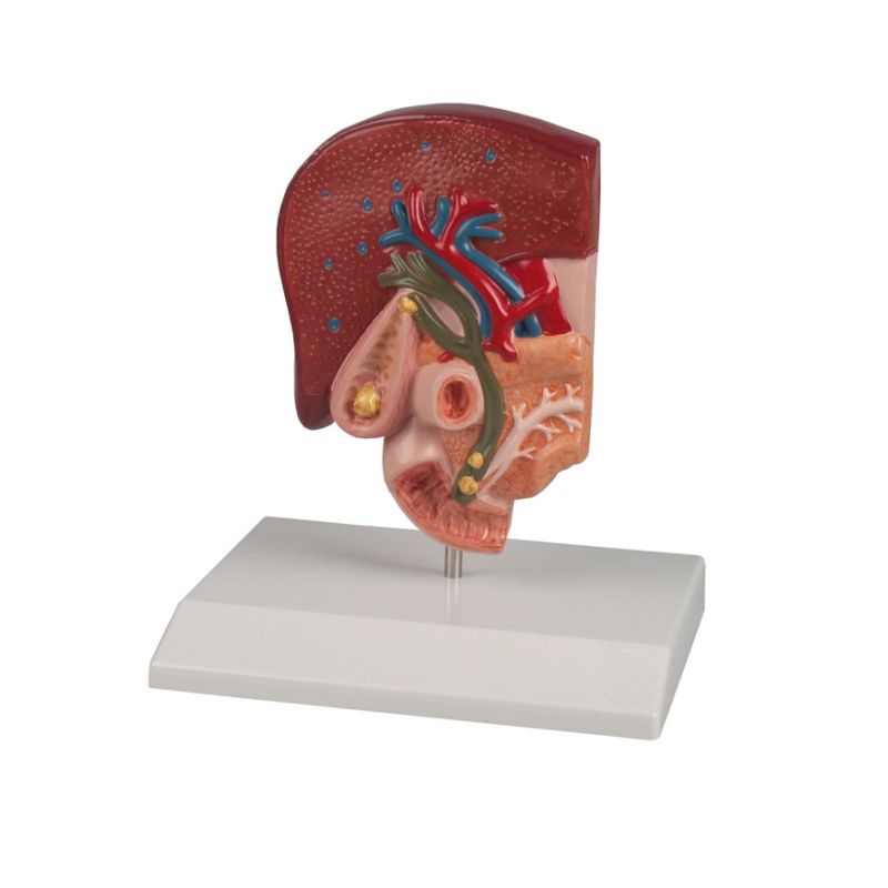 Erler-Zimmer Gallstone Model - MedicalSupplies.co.uk