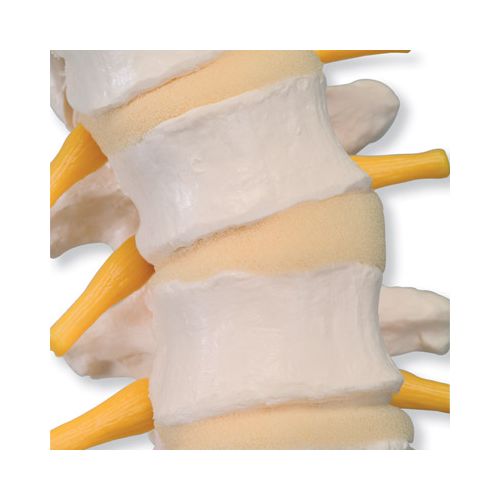 Flexible Spine with Soft Intervertebral Discs VB84 - MedicalSupplies.co.uk