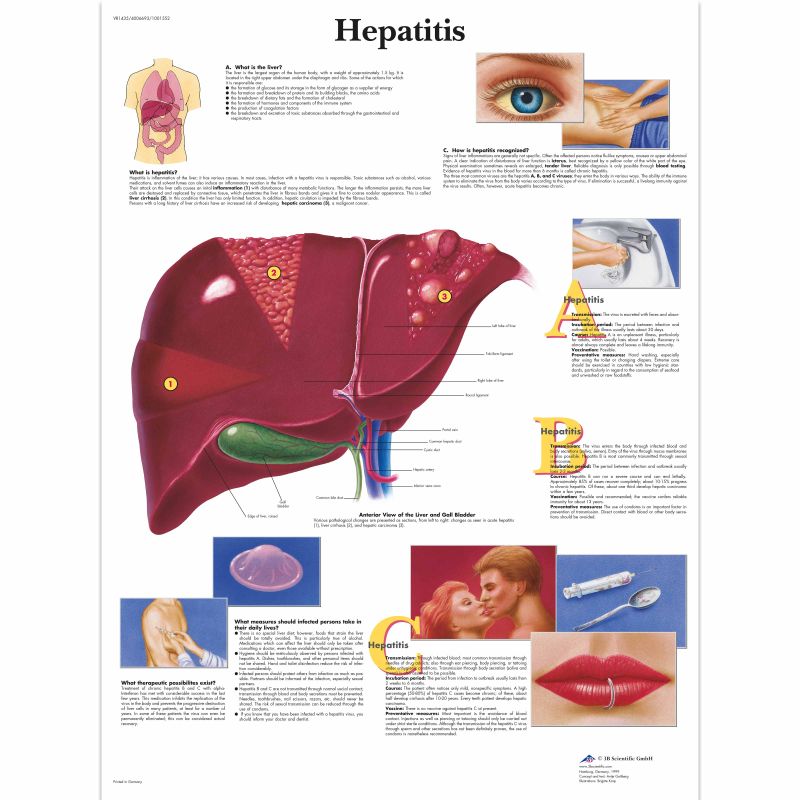 Hepatitis Chart - MedicalSupplies.co.uk