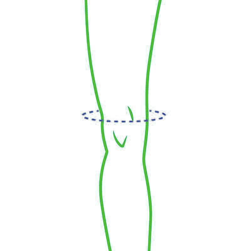 Vulkan Classic Hinged Knee Support - MedicalSupplies.co.uk