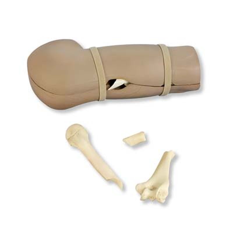 Life/Form Imaging Fracture Simulator - MedicalSupplies.co.uk