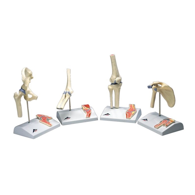 Mini Joint Series with Cross-Section - MedicalSupplies.co.uk