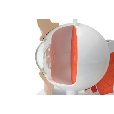 Pathological Eye Model - MedicalSupplies.co.uk