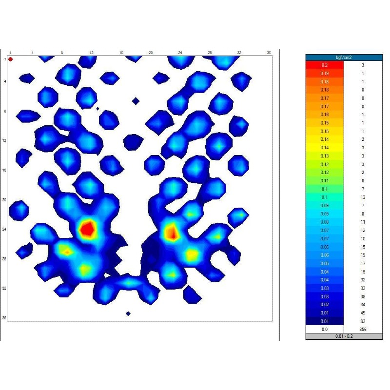 Putnams Prostate Cut Out Cushion - MedicalSupplies.co.uk