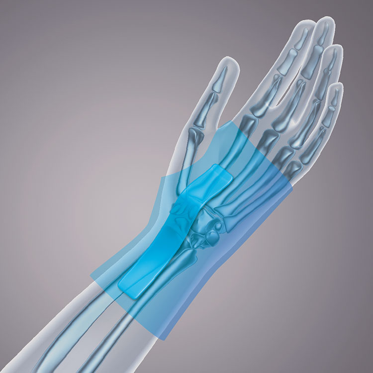 Oppo Stabilised Wrist Support Splint - MedicalSupplies.co.uk
