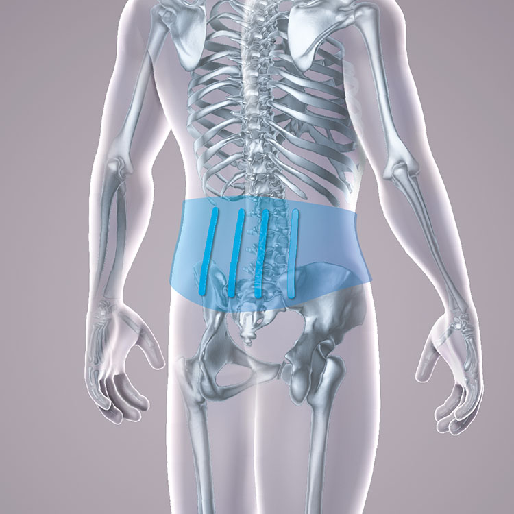 Oppo Back Stabilising Support Brace - MedicalSupplies.co.uk