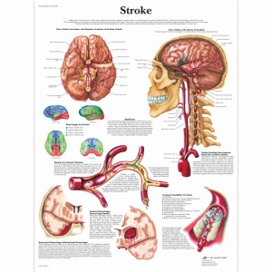 Stroke Chart - MedicalSupplies.co.uk